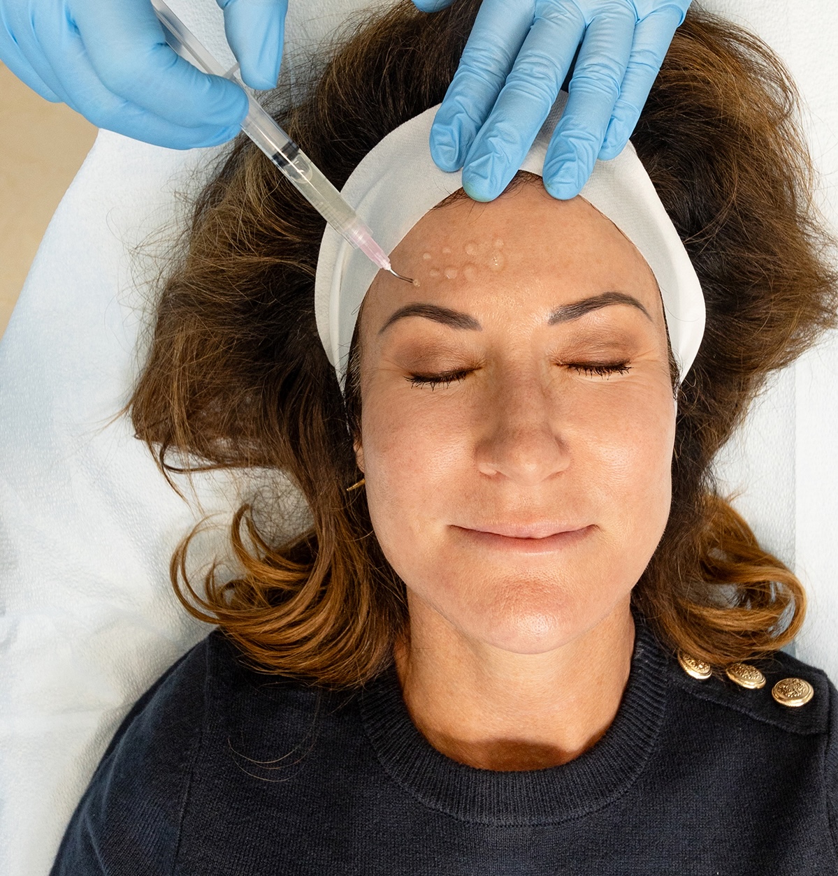 PRX DERM PERFEXION | Newport Beach, CA | Image Perfect Laser